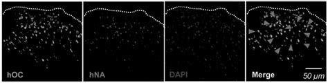 6 Osteoblastic Differentiation Of Hmads Cells During Callus Formation Download Scientific