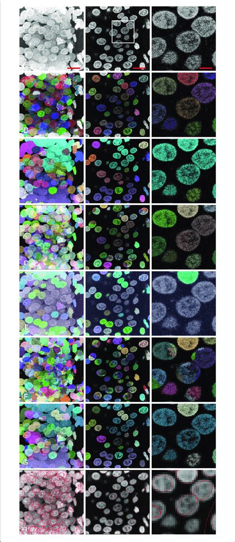 Comparison Of Segmentation Results With Different Other Methods A Download Scientific