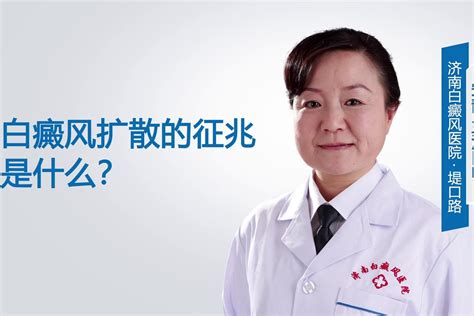 山东济南白癜风医院宋静医生：白癜风扩散有什么征兆？凤凰网视频凤凰网