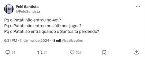 Sormani Questiona Carille Por Perseguição Com Patati No Santos Não