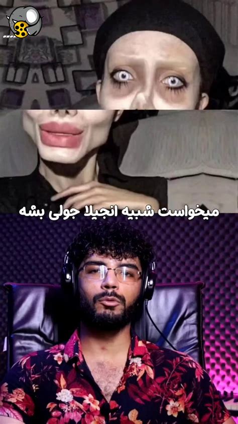 بدترین جراحی‌های دنیا فیلو