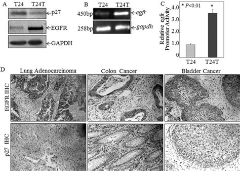 Inverse Correlation Of P27 Kip1 And Egfr Expression In Human Bladder