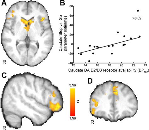 Table 1 From Striatal Dopamine D2d3 Receptors Mediate Response