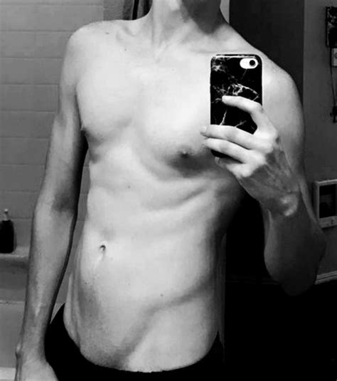 My Pic Callous