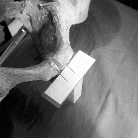 In One Leg Standing The Symphyseal Cleft Is Narrowest In Its Caudal