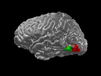 Synesthesia Wikipedia