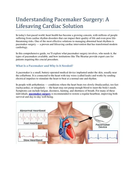 Ppt Understanding Pacemaker Surgery A Lifesaving Cardiac Solution