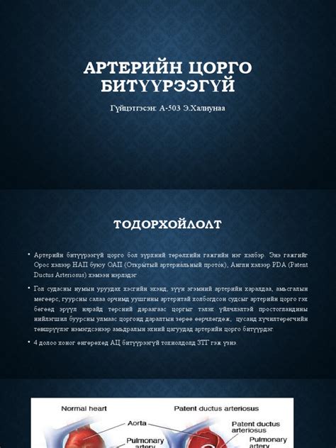 Артерийн цорго битүүрээгүй Pdf
