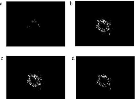 A Output Binary Image Of Stage 1 I1 B Binary Image With Possible