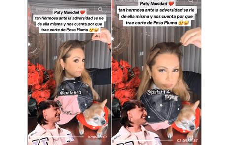 Paty Navidad está pelona revela cómo quedó después de que le