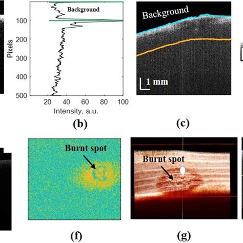 Algorithm Method Of Oac Maps And 3 D Visualization A Oct Image Of Download Scientific