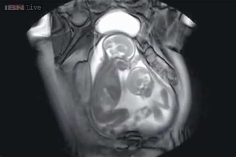 Watch The Process Of Kissing Sex Talking And Giving Birth Look