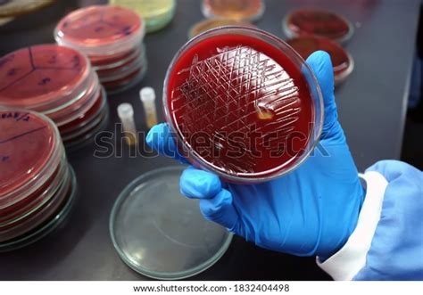Streptococcus Suis ภาพสต็อกปลอดค่าลิขสิทธิ์และรับสิทธิ์ใช้งานได้กว่า 9