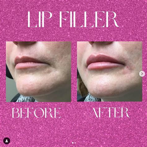 Monarch Plastic Surgery And Skin Rejuvenation Center Home
