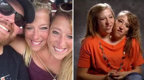 Conjoined Twins Abby And Brittany Hensel Would Make History If One Of