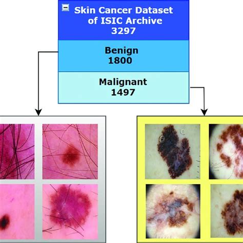 Skin Cancer Isic Archive Dataset Download Scientific Diagram
