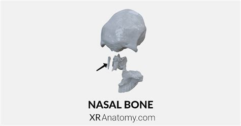 Nasal Bone In Ar For Free