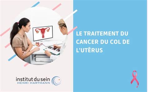 Les traitements du cancer du col de lutérus Avis d expert