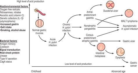 Helicobacter Pylori Clinical Tree