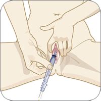 Guide To Self Catheterisation For Women EMEA