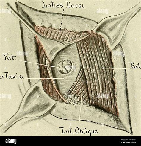 Lumbar Triangle Cadaver