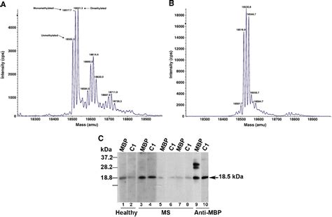 Figure 1 From Anti Myelin Antibodies Modulate Clinical Expression Of