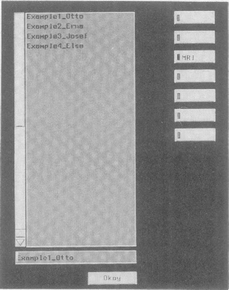 Figure 2 From Visualization Of Multimodal Image Information In Medicine