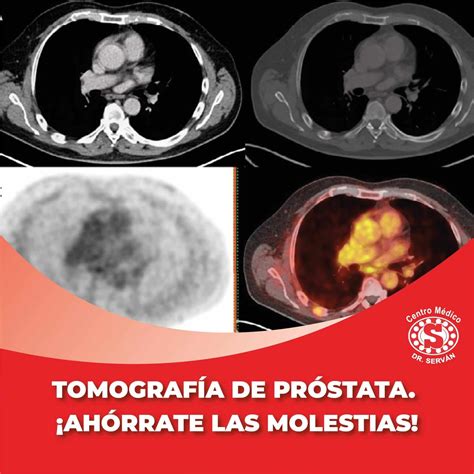 Resonancia Magnética Tórax Centro Médico Dr Serván