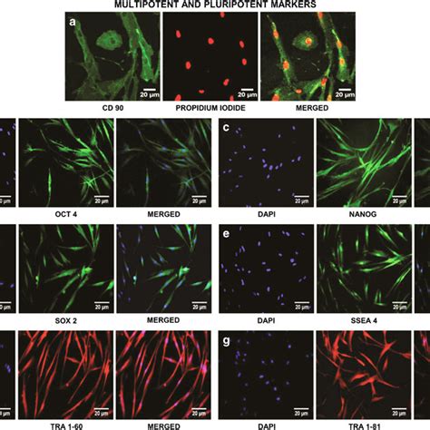 Morphology Of Cultured Gingival Cells From Gingival Tissue The
