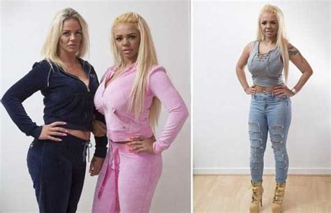 Mother And Daughter Who Clearly Overused Plastic Surgery Klykercom
