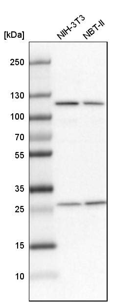 Rabbit Polyclonal Anti Aars Antibody Buy For Research Highly