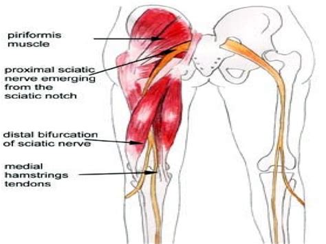 Sciatic Nerve Sciatic Nerve Sciatic Nerv Ppt