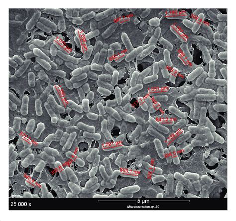 Size And Cell Measurement Of Microbacterium Sp 2c By Sem Observation