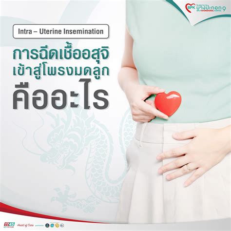 การฉีดเชื้ออสุจิเข้าสู่โพรงมดลูก Intra Uterine Insemination หรือ Iui