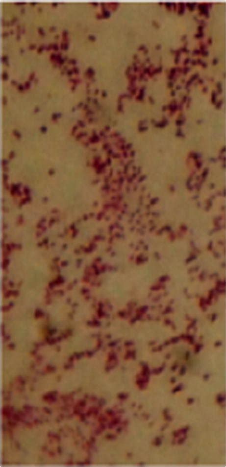 Microscopic Morphology Of The Isolated Bacteria Shows Gram Negative
