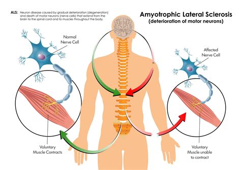 Neurone Moteur Fonction Types Et Structure