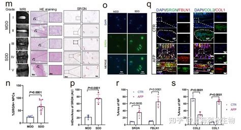 烈冰助力 Nat Commun（if 166）髓核组织的单细胞分析揭示椎间盘退变的生物标志物 知乎