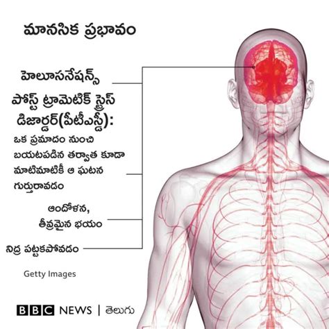 ఉత్తరకాశీ సొరంగంలో ఎక్కువ రోజులు ఉంటే మానసికంగా శారీరకంగా ఎలాంటి