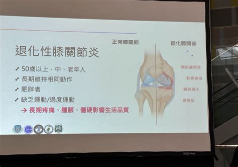 88歲嬤退化性關節炎，換膝蓋隔天就能行走！醫揭關鍵授護膝8招 健康遠見