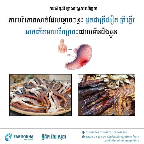 👉ឧស្សាហ៍ញ៉ាំ ត្រីងៀត ត្រីឆ្អើរ អាចកើតមហារីកក្រពះដោយមិនដឹងខ្លួន មាន មូល
