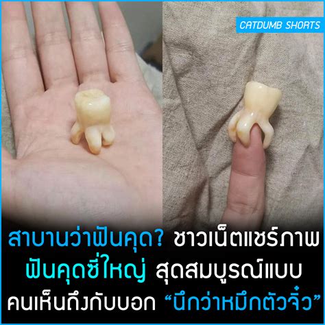 สาบานวาฟนคด ชาวเนตแชรภาพ ฟนคดซใหญ สดสมบรณแบบ คนเหนถงกบ