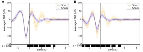 Performance Of An Ambulatory Dry Eeg Device For Auditory Closed Loop Stimulation Of Sleep Slow