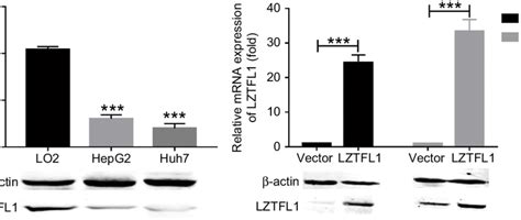 LZTFL Expression In Hepatocellular Carcinoma HCC Cell Lines A The