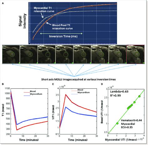 A Myocardial T1 Mapping Using The Modified Look Locker Inversion Download Scientific Diagram