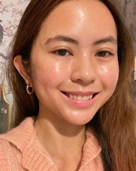 Why This Red Blush By Refy Is Ideal For Acne Prone Skin