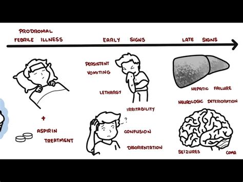 Caplan Syndrome Armando Hasudungan