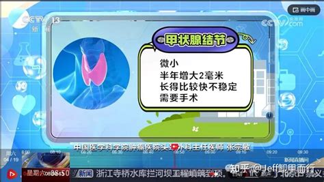 张宗敏上央视，怎么突然变老实了？ 知乎