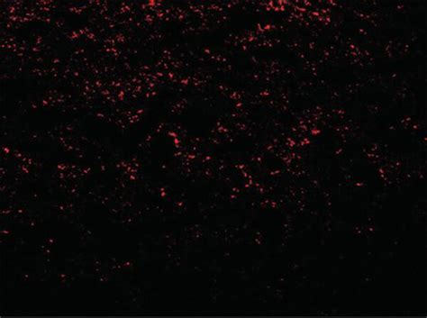 Catalase In Neurodegenerative Diseases Rockland