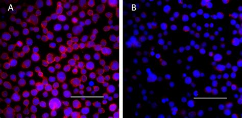 Purified Anti Akt Phospho Ser473 Antibody Akt Phospho Ser473 A21001c