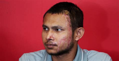 Malaysian Footballer Faisal Halim Calls For Justice After Acid Attack